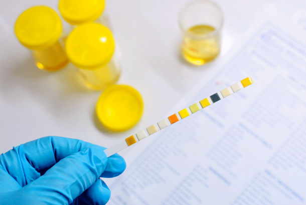 Six Things Your Pee Can Tell You – Loco Cycles